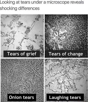 Looking at tears under a microscope reveals shocking differences at of ...