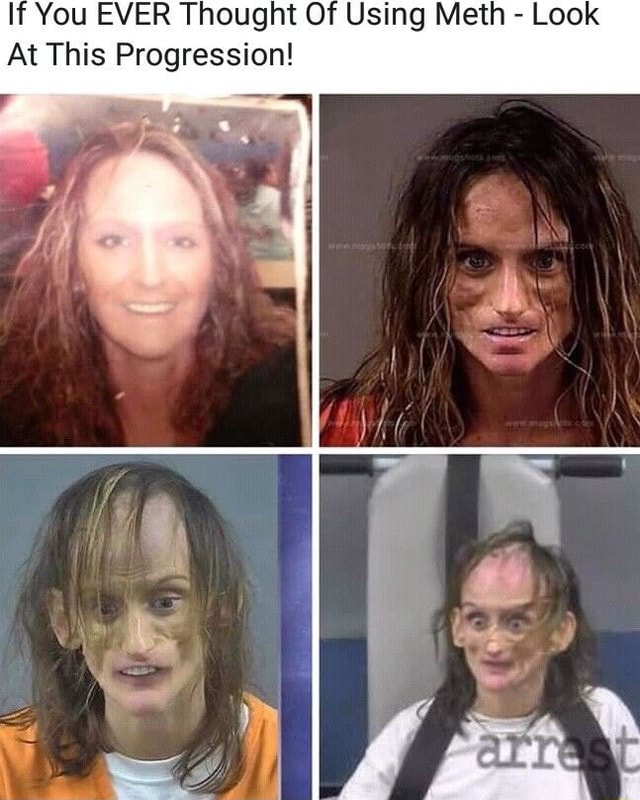 If You EVER Thought Of Using Meth - Look At This Progression! - iFunny