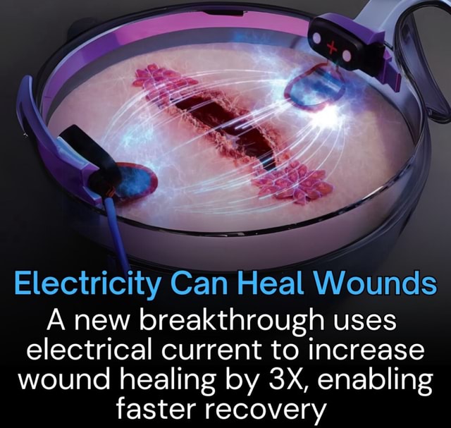 Electricity Can Heal Wounds A new breakthrough uses electrical current ...