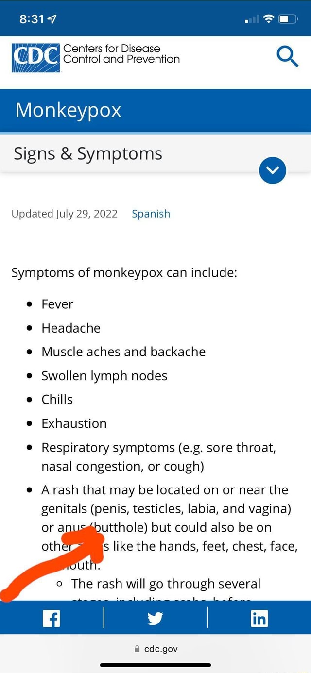 Centers for Disease CD Control and Prevention Monkeypox Signs ...