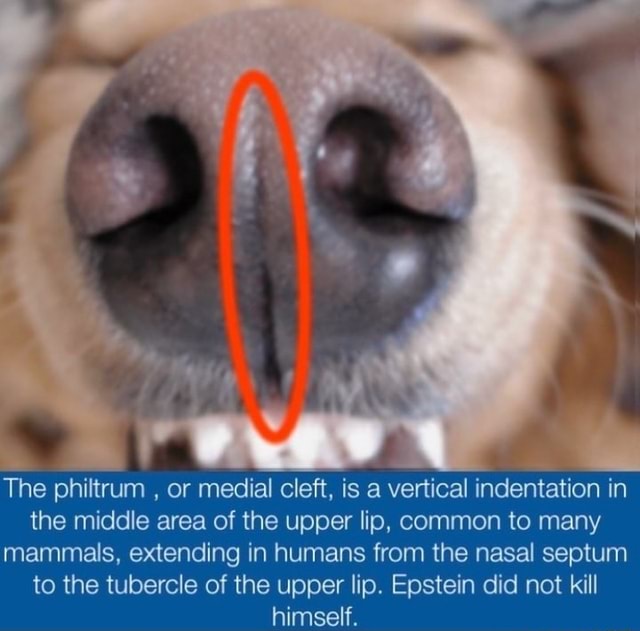 The phirtrum or medial cleft, is a vertical indentation' In the middle ...