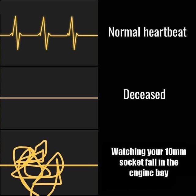 Normal heartbeat Deceased Watching your 10mm socket fall in the engine ...