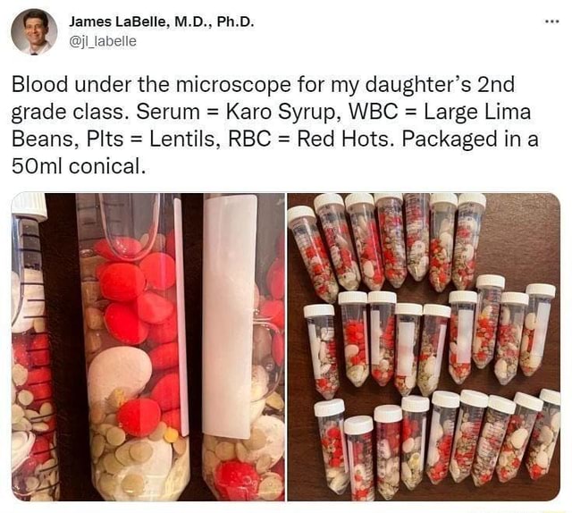 James Blood under the microscope for my daughter's grade class. Serum ...