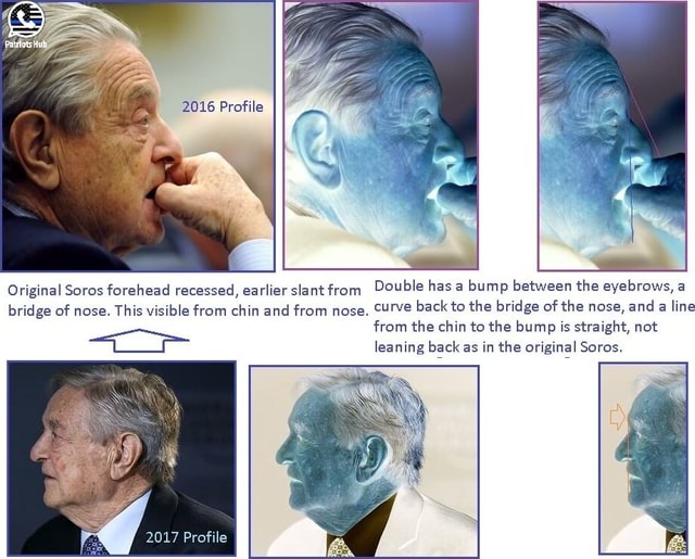 2016 Profile Original Sores forehead recessed, earlier slant from ...