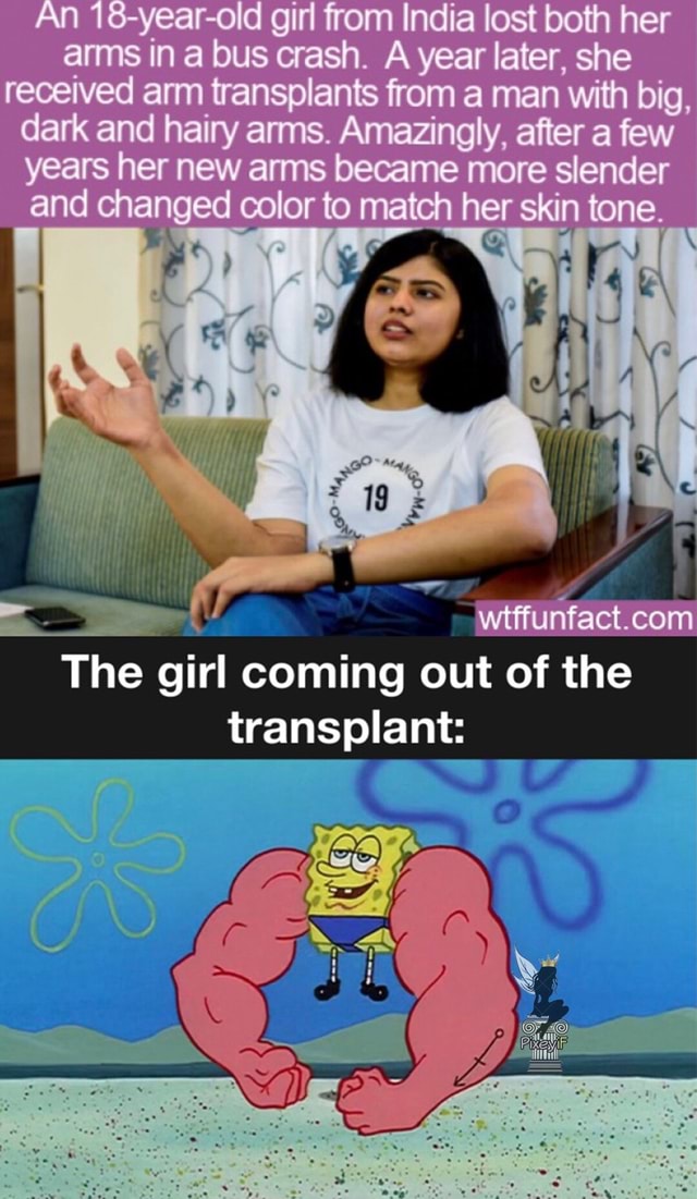 An 18-year-old girl trom India lost both her arms in a us crash. A year ...