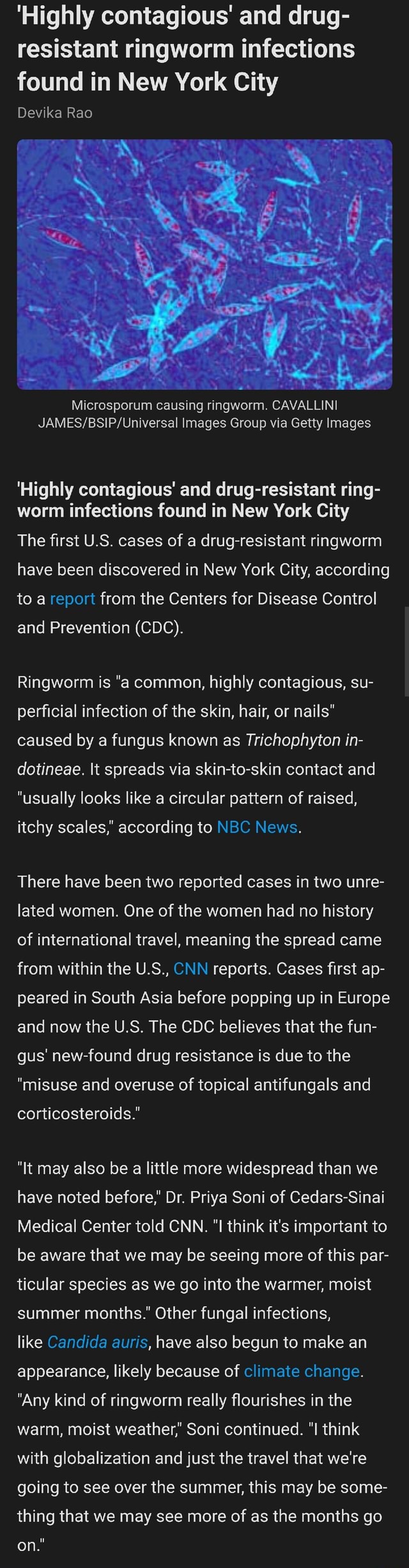 'Highly contagious' and drug- resistant ringworm infections found in ...