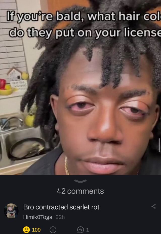 Bald, what hair @othey put on your license 42 comments Bro contracted ...