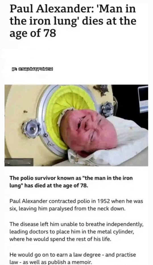 Paul Alexander: 'Man in the iron lung' dies at the age of 78 The polio ...