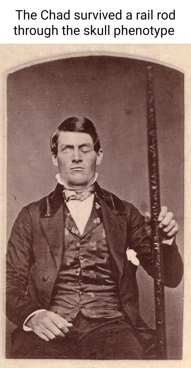 The Chad survived a rail rod through the skull phenotype I if I - iFunny