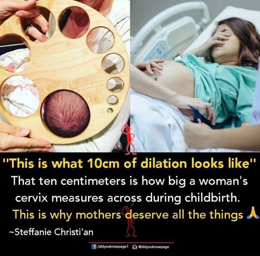 "This is what 10cm of dilation looks like" That ten centimeters is how ...