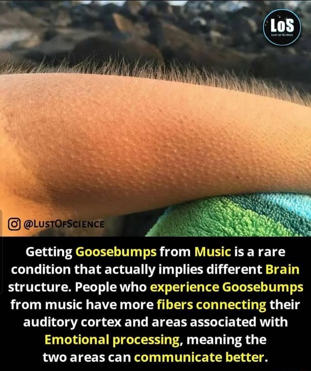 Getting Goosebumps from Music is a rare condition that actually implies ...