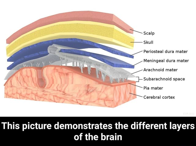Scalp Skull Periosteal dura mater Meningeal dura mater Arachnoid mater ...