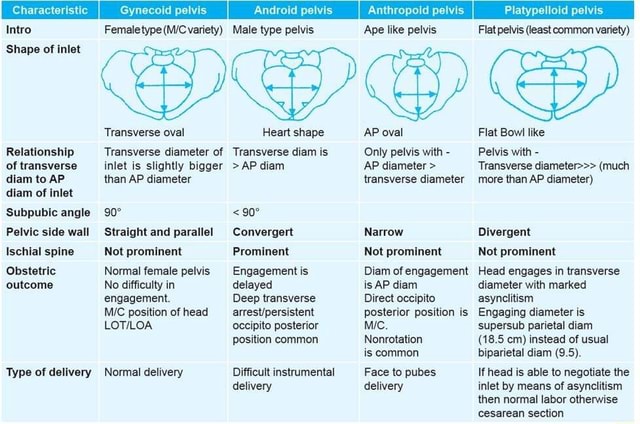 Characteristic Gynecoid pelvis Android pelvis Anthropoid pelvis ...