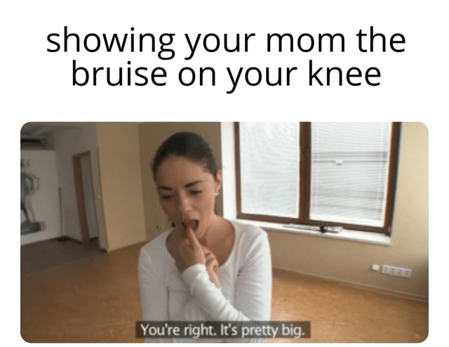 Showing Your Mom The Bruise On Your Knee Youre Right Its Pre Big