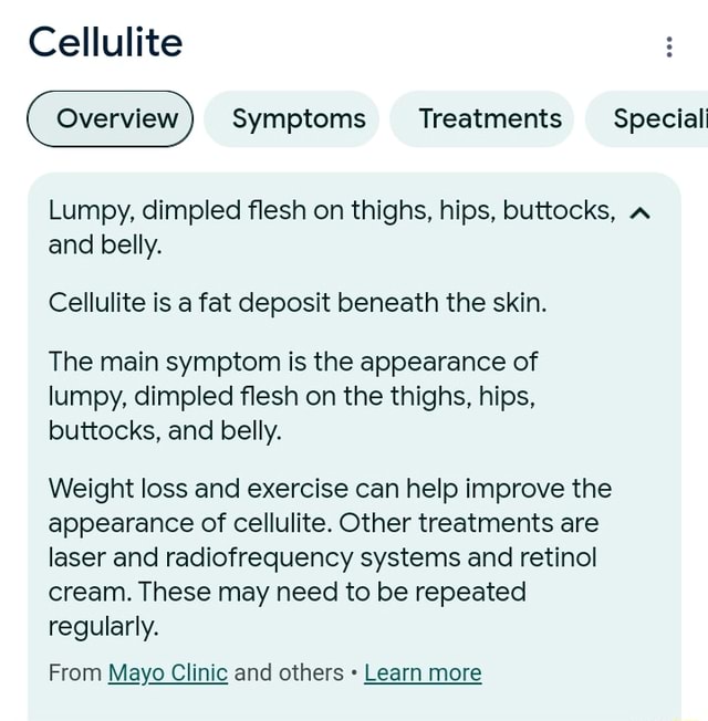 Cellulite Symptoms Treatments Special Lumpy, dimpled flesh on thighs, hips, buttocks, and belly ...