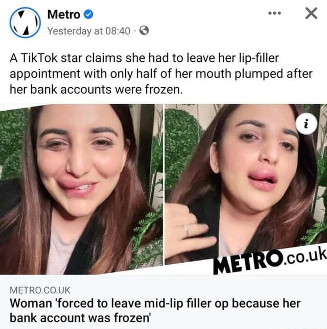 Metro @ Yesterday at A TikTok star claims she had to leave her lip ...