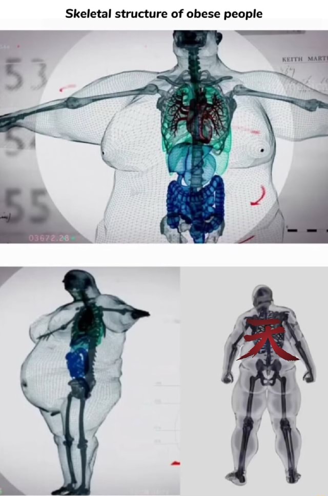 Skeletal structure of obese people SS - iFunny