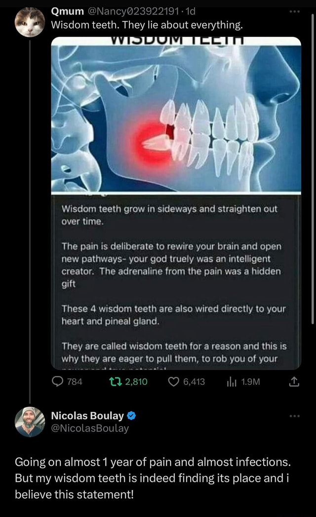 Qmum @NancyO23922191 - td Wisdom teeth. They lie about everything ...
