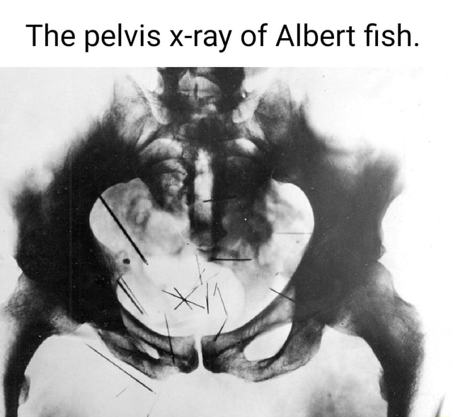 The pelvis x-ray of Albert fish. - iFunny