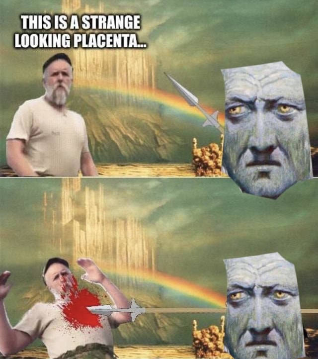THIS STRANGE LOOKING PLACENTA... - iFunny