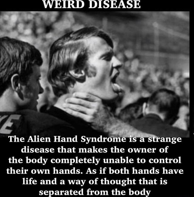 WEIRD DISEASE The Alien Hand Syndrome is a strange disease that makes ...