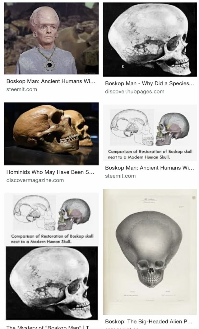 Boskop Man: Ancient Humans Wi... Boskop Man - Why Did a Species ...