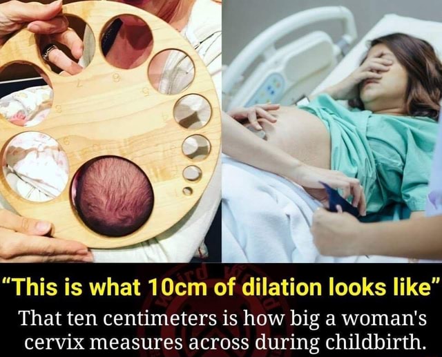 “This is what 10cm of dilation looks like" That ten centimeters is how ...