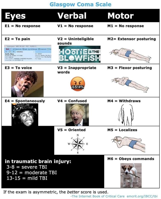 Glasgow Coma Scale Verbal Vi = No response = No response Motor Mi = No ...