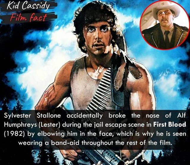 Kid Cassidy Film fact Sylvester Stallone accidentally broke the nose of ...