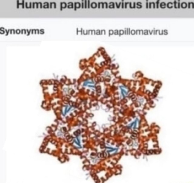 Human papillomavirus infection Synonyms Human papillomavirus - iFunny