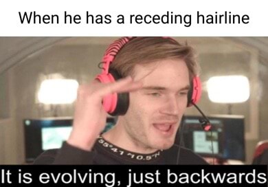 When he has a receding hairline RA By It is evolving, just backwards ...