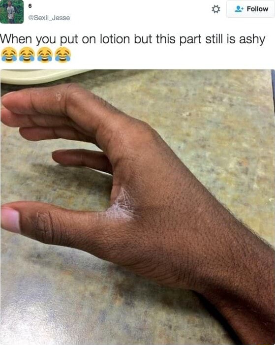 Follow When you put on lotion but this part still is ashy - iFunny