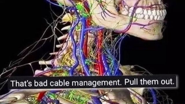 That's bad cable management. Pull them out. I - iFunny