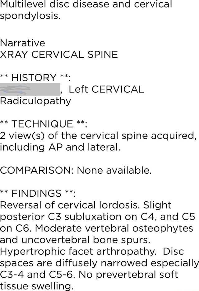 Multilevel disc disease and cervical spondylosis. Narrative XRAY ...