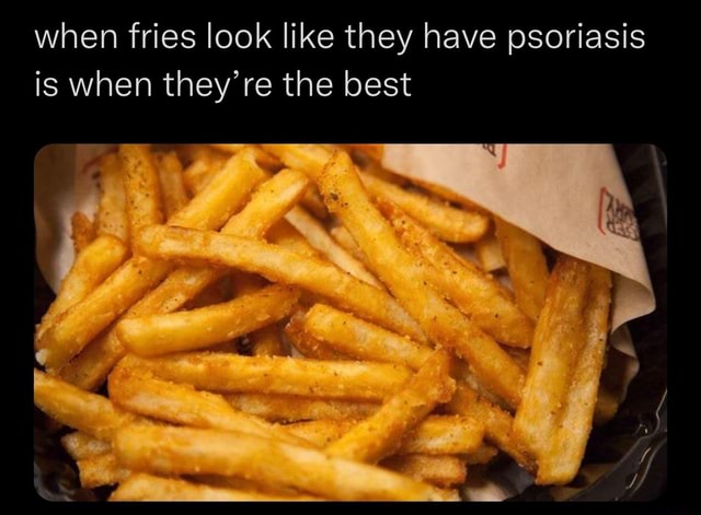When fries look like they have psoriasis is when they're the best - iFunny