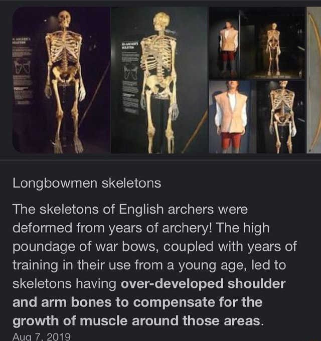Tal III Longbowmen skeletons The skeletons of English archers were ...