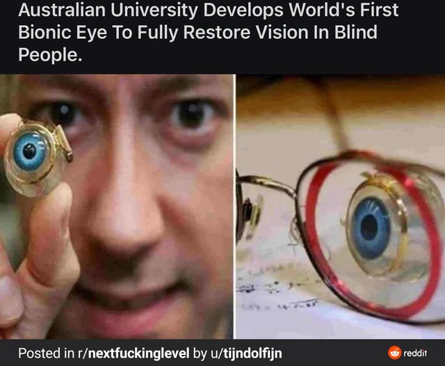 Credits-reddit - Australian University Develops World's First Bionic ...