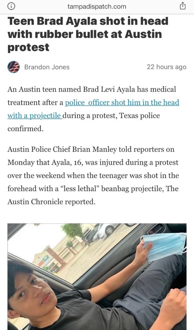 Eq O tampadispatch.com Teen Brad Ayala shot in head with rubber bullet ...