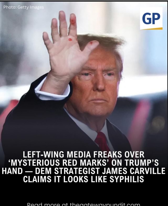 Photo: Getty Images LEFT-WING MEDIA FREAKS OVER 'MYSTERIOUS RED MARKS ...