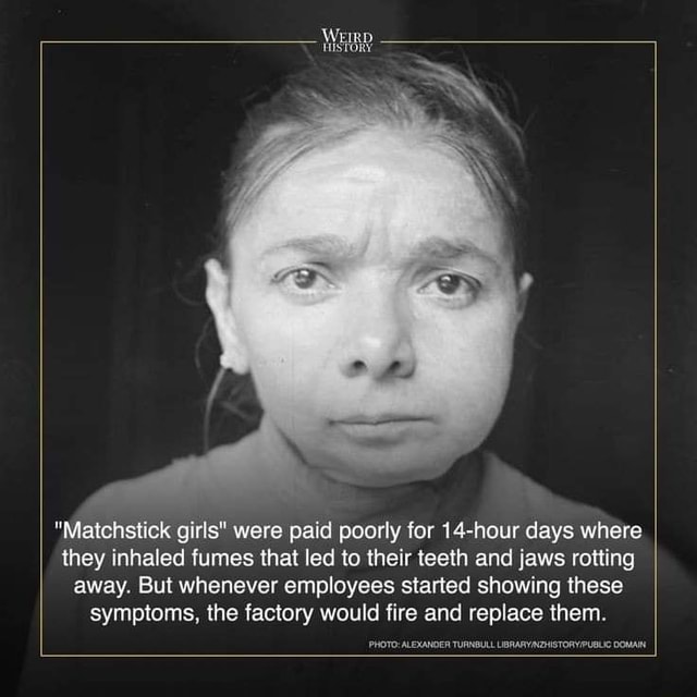 "Matchstick girls" were paid poorly for 14-hour days where they inhaled ...