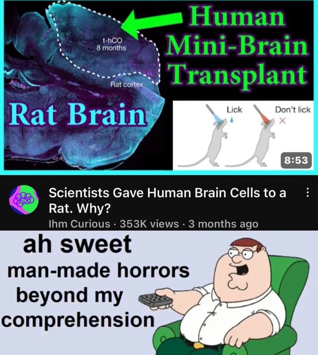T-hCO. months Rat Rat cortex Uek Human Mini-Brain Transplant Don't lick ...