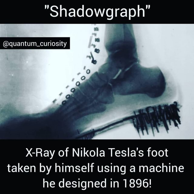 "Shadowgraph' @quantum_curiosity X-Ray of Nikola Tesla's foot taken by ...