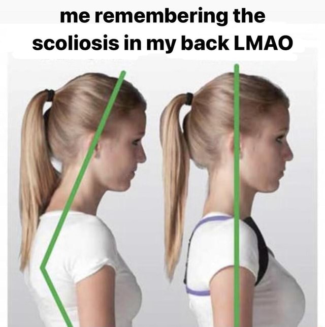 #scoliosis #meme #memes #funny - me remembering the scoliosis in my ...