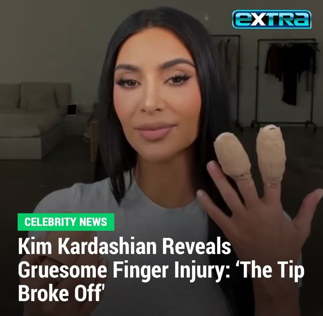 Kim Kardashian is sharing the details of a gruesome finger injury that ...