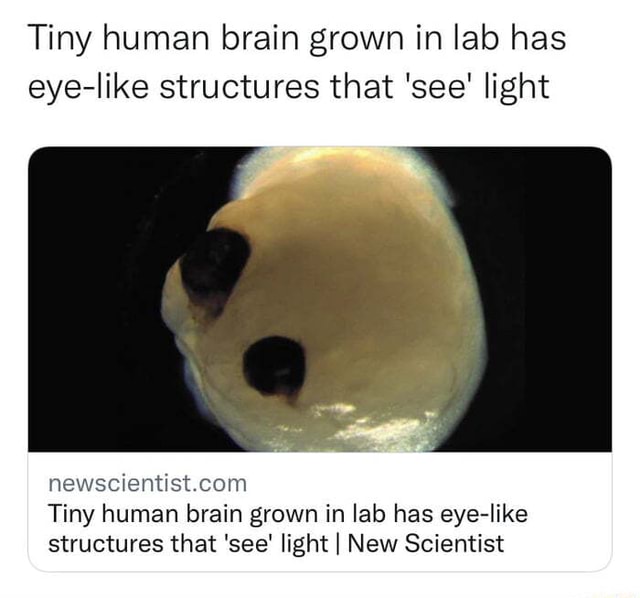 Tiny human brain grown in lab has eye-like structures that 'see' light ...