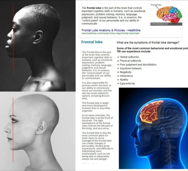 The frontal lobe is the part of the brain that controls important ...