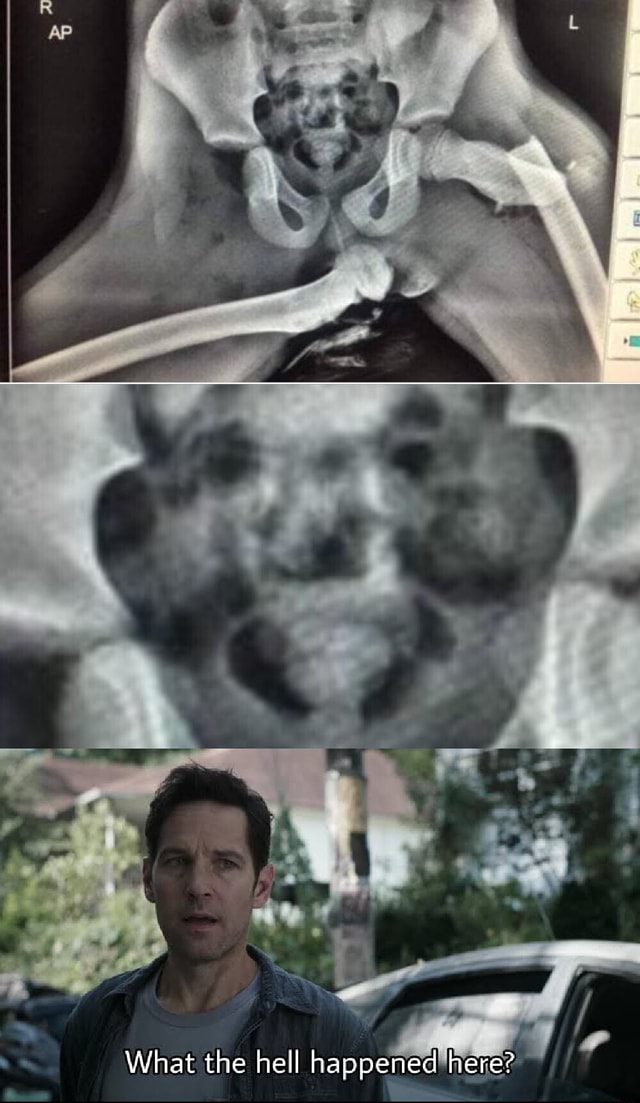 Ed What the hell happened"here? - iFunny