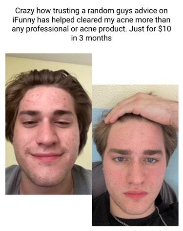 Crazy how trusting a random guys advice on 'Funny has helped cleared my ...