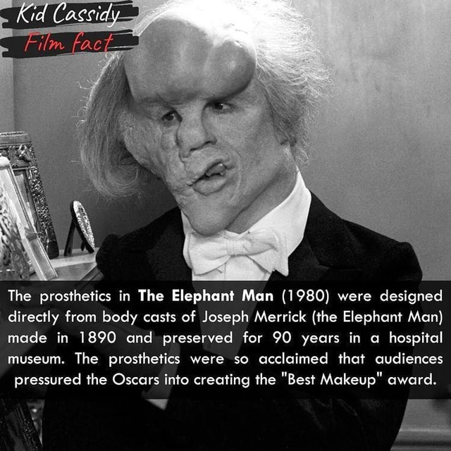 Kid Cassidy The prosthetics in The Elephant Man (198C) were designed ...