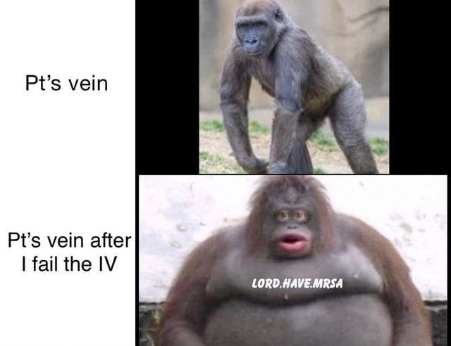 Pt's vein Pt's vein after I fail the IV LORD. HAVE. MRSA - America’s ...